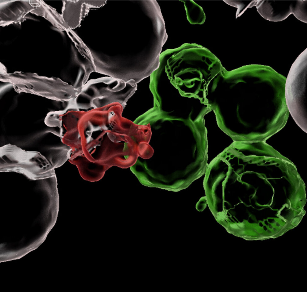 Research Areas - Leibniz Institute for Immunotherapy